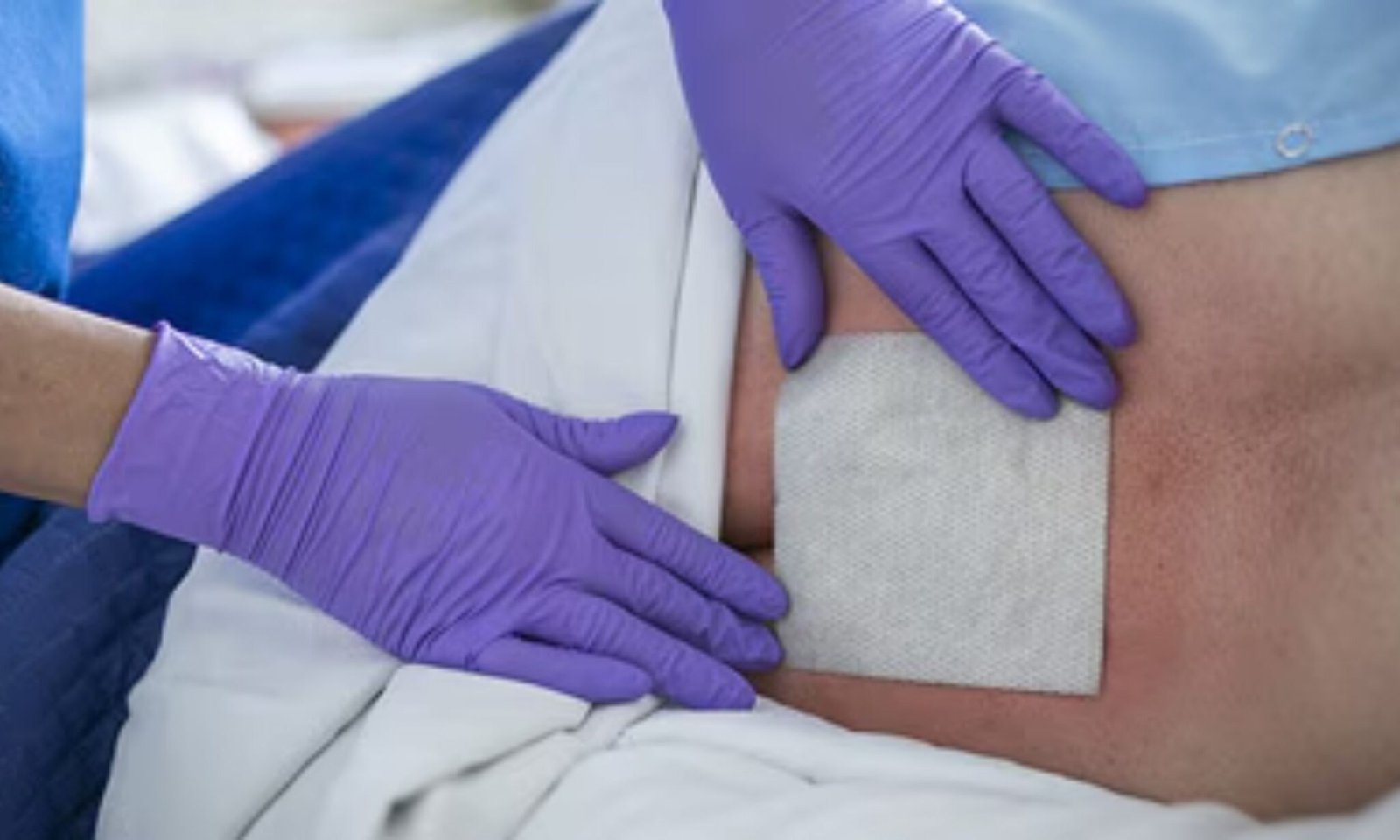 Best Treatments for Pressure Ulcers: From Care to Therapy