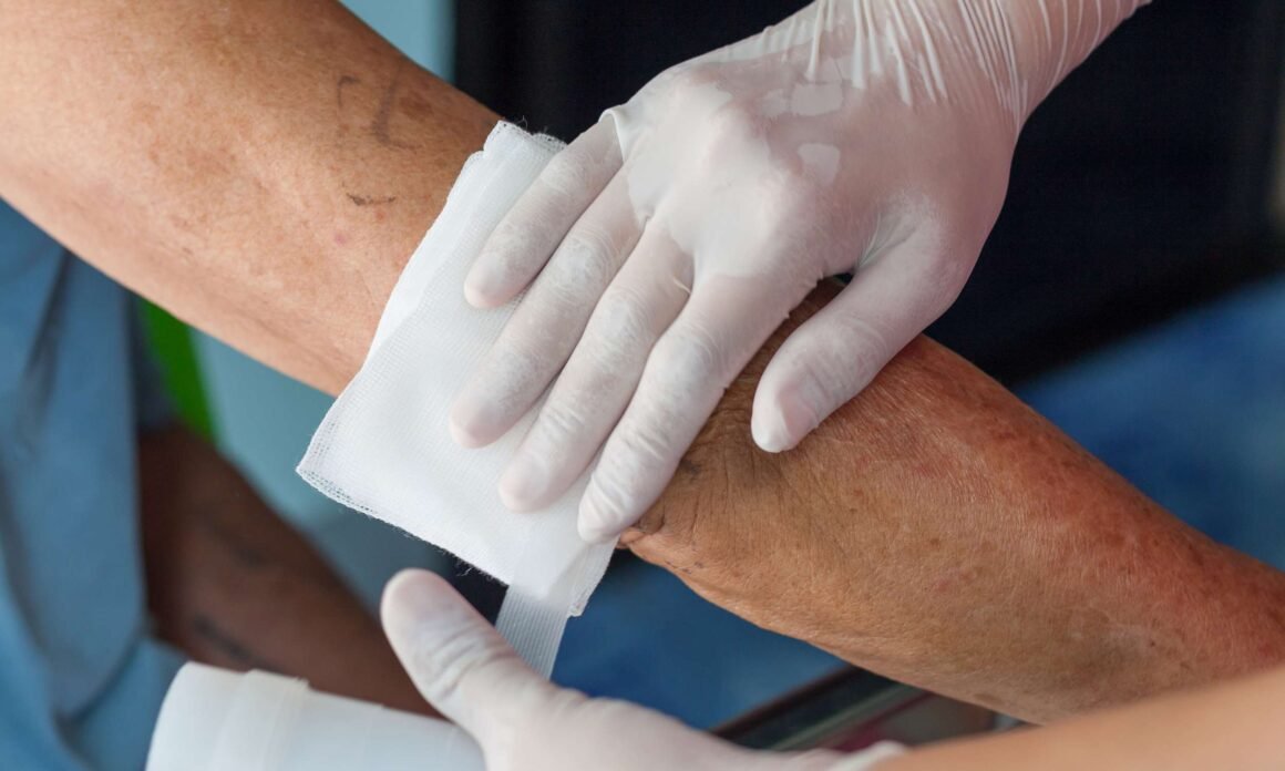 Daily Care Tips to Prevent Infections in Venous Leg Ulcers